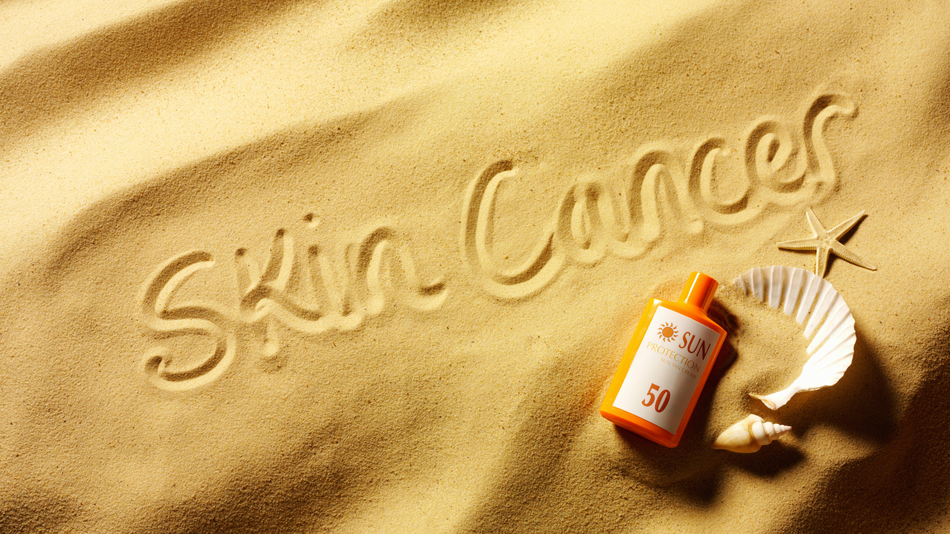 Preventing Skin Cancer: How To Be a Sun-Smart | Chemco Pharmacy